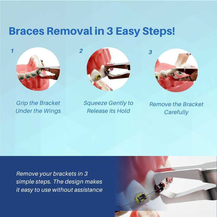 High-Quality Orthodontic Pliers for Braces & Wire Adjustments – Artman ...